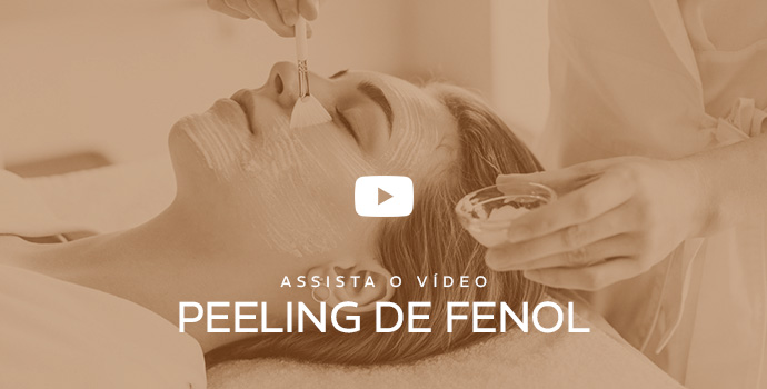 Peeling de Fenol – Dra Giovanna Horcel